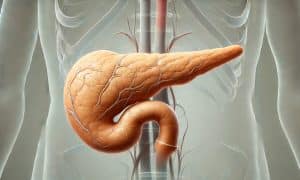 Tumore al Pancreas: Sintomi, Aspettative di Vita e Cura del Cancro